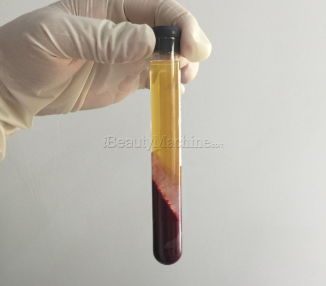 PRP Kits for microneedling | high quality 8mL PRPTubes | syringes and ...