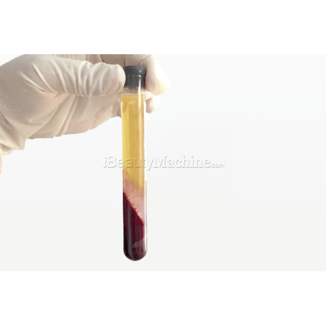 Platelet Rich Plasma Tubes