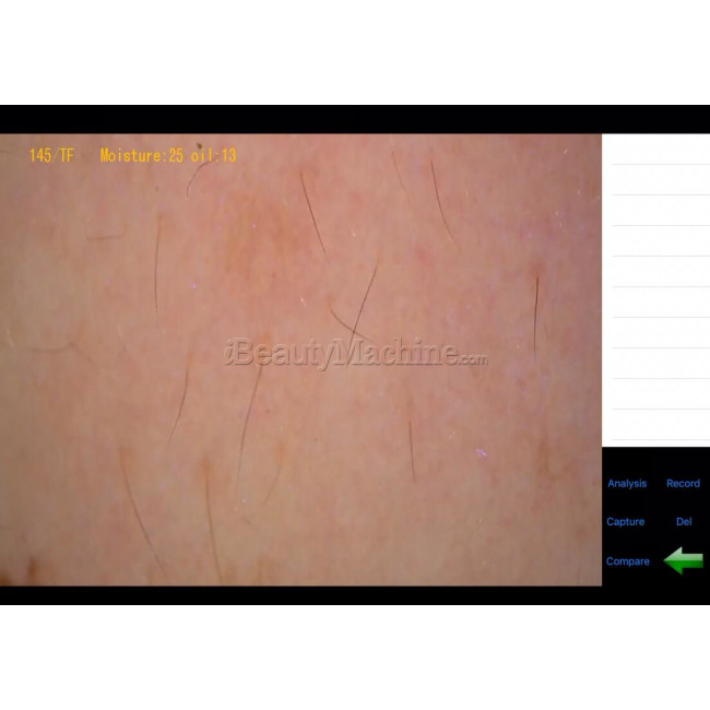 Smart Skin Analyzer | Wireless Skin Camera | portable skin scope ...