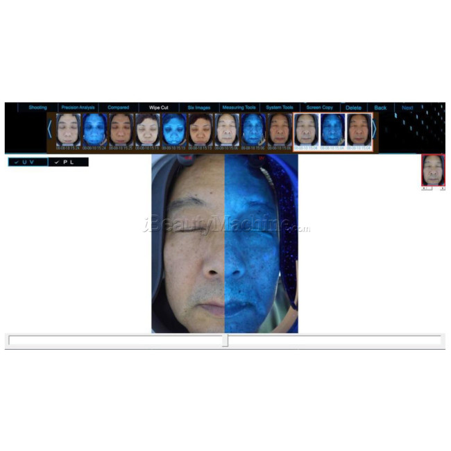 Hi-Res Smart Face Mirror System | Smart Skin Analyzer | skin analysis ...