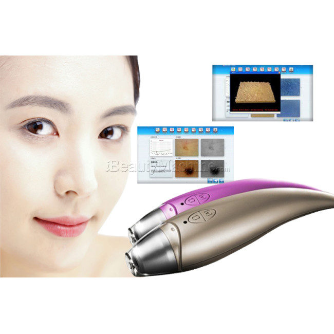 Intelligent 3D UV Skin Analyzer