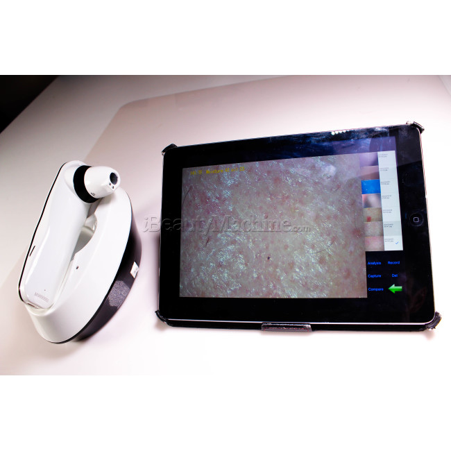 Smart Skin Analyzer | Wireless Skin Camera | portable skin scope ...