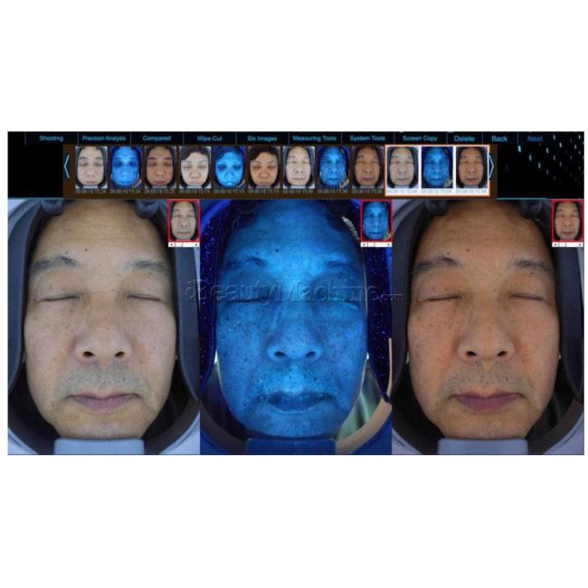 Hi-Res Smart Face Mirror System | Smart Skin Analyzer | skin analysis ...