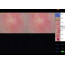 Smart Skin Analyzer | Wireless Skin Camera | portable skin scope ...